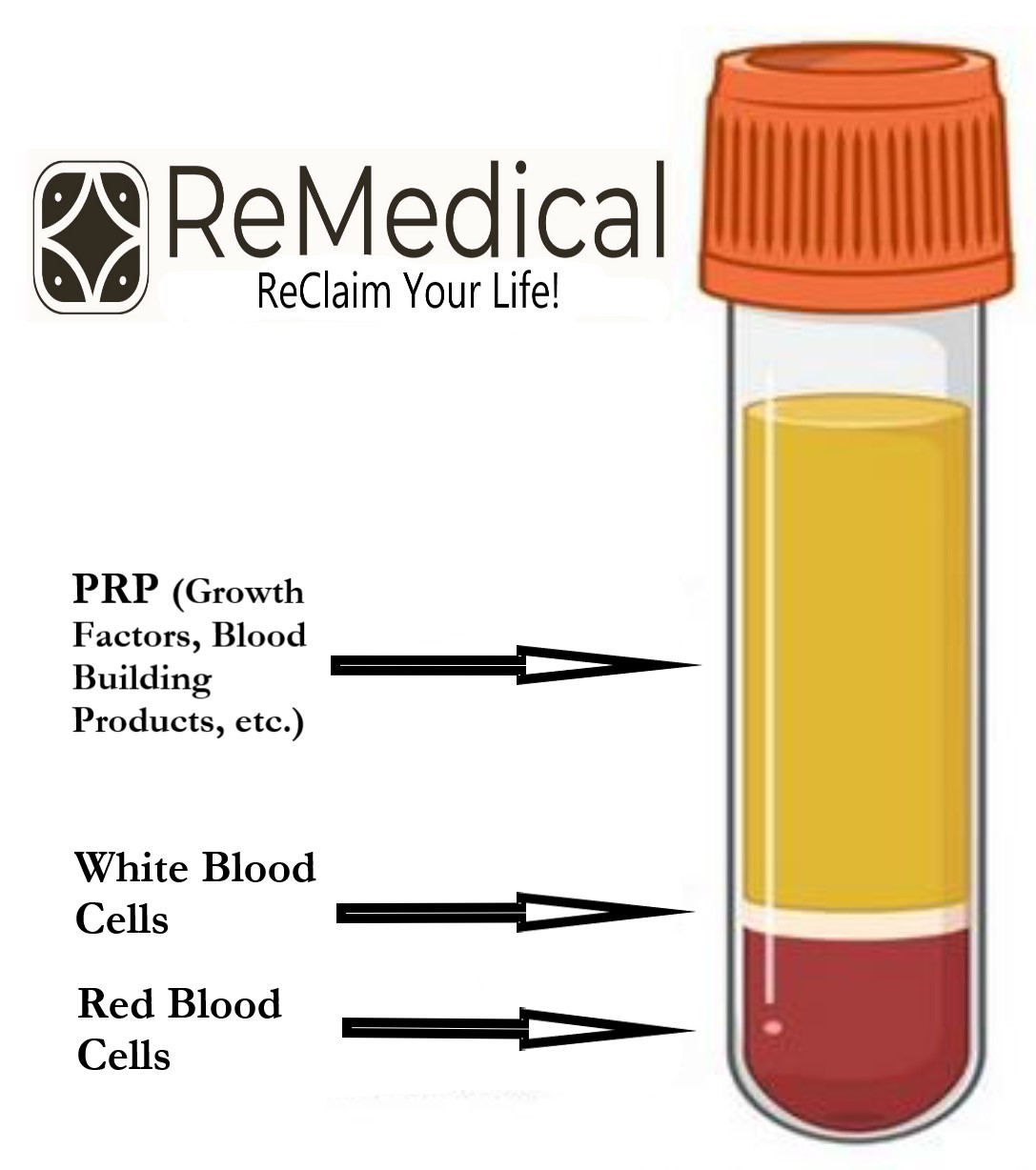 The Technology for the best Sexual Wellness Treatments In Utah | ReMedical